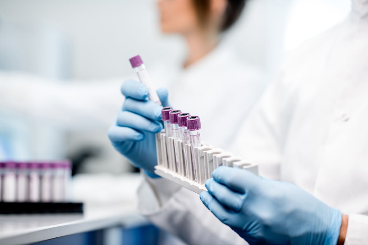 Approvals and Orders for Co-Diagnostics' COVID-19 Test Kits Are on the ...